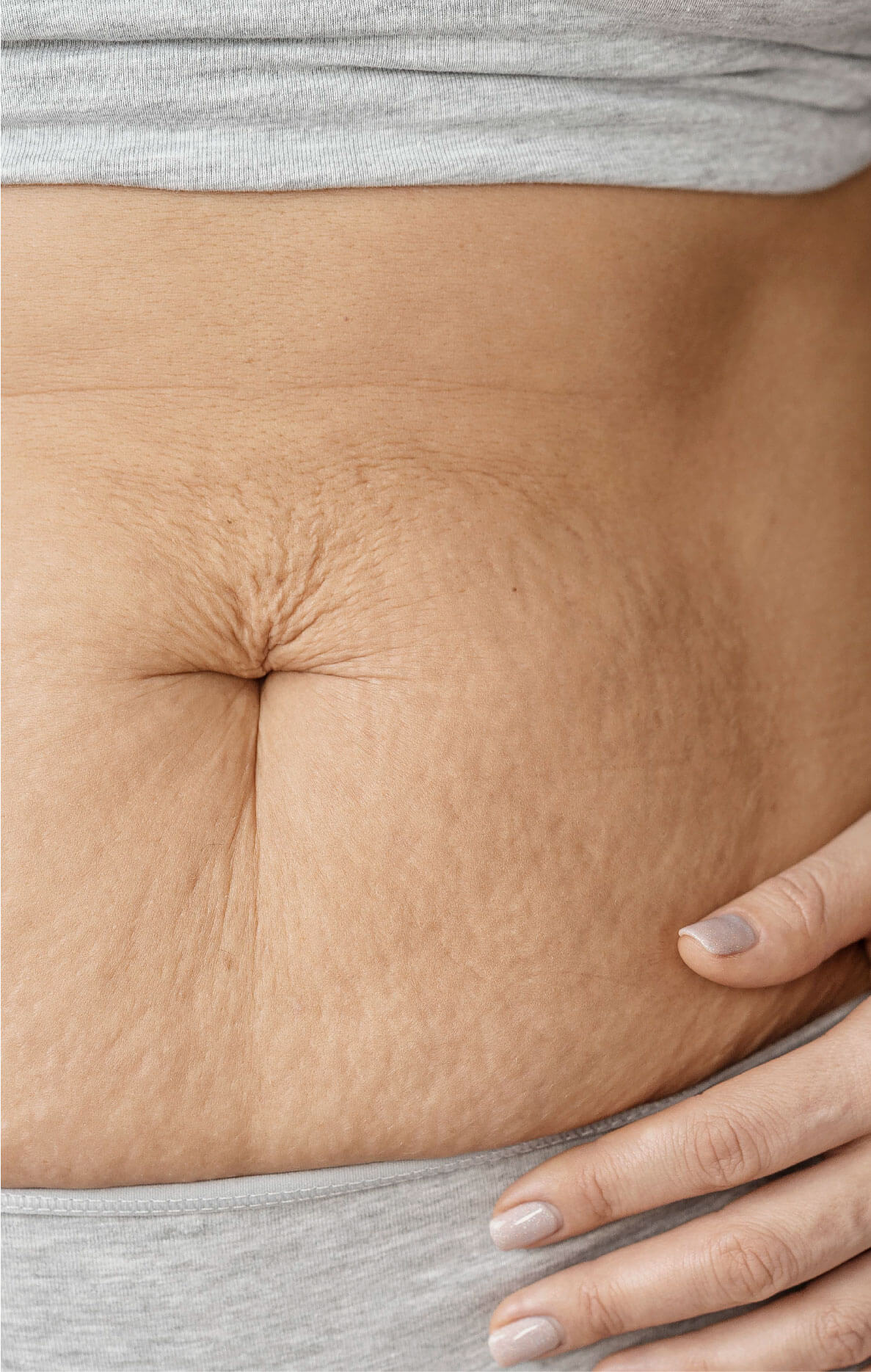 十倍電波10 THERMA- 肌膚回彈緊緻再現| 原綺診所 LA LUEUR